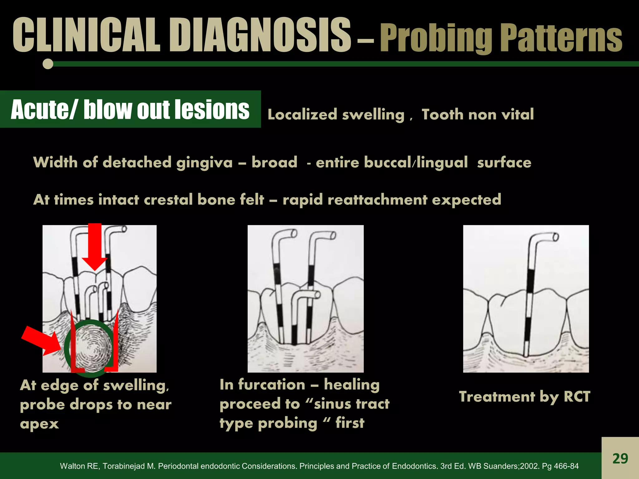 Endodontic Periodontal Relationship, ENDO PERIO LESION | PPTX