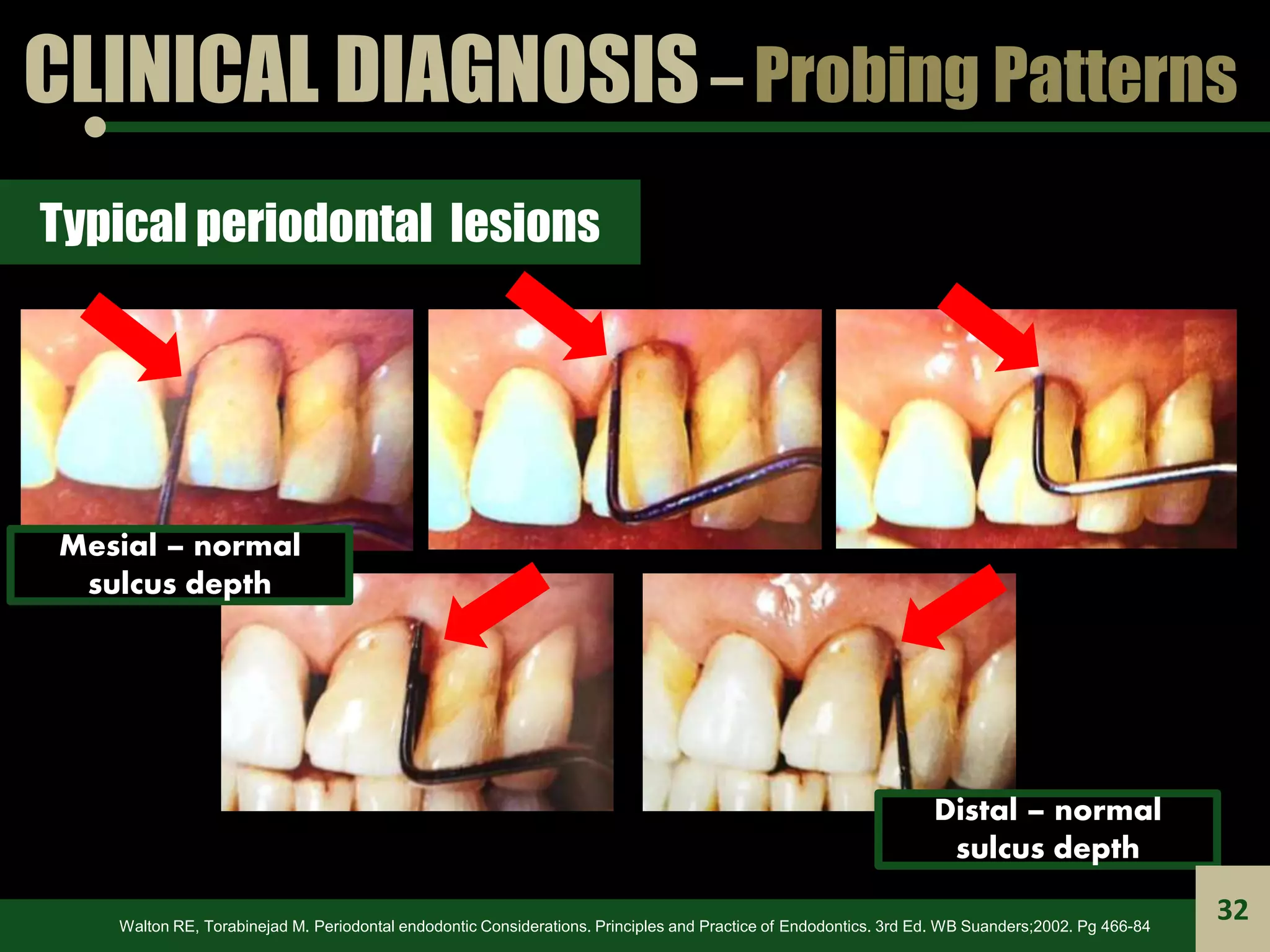 Endodontic Periodontal Relationship Endo Perio Lesion Pptx
