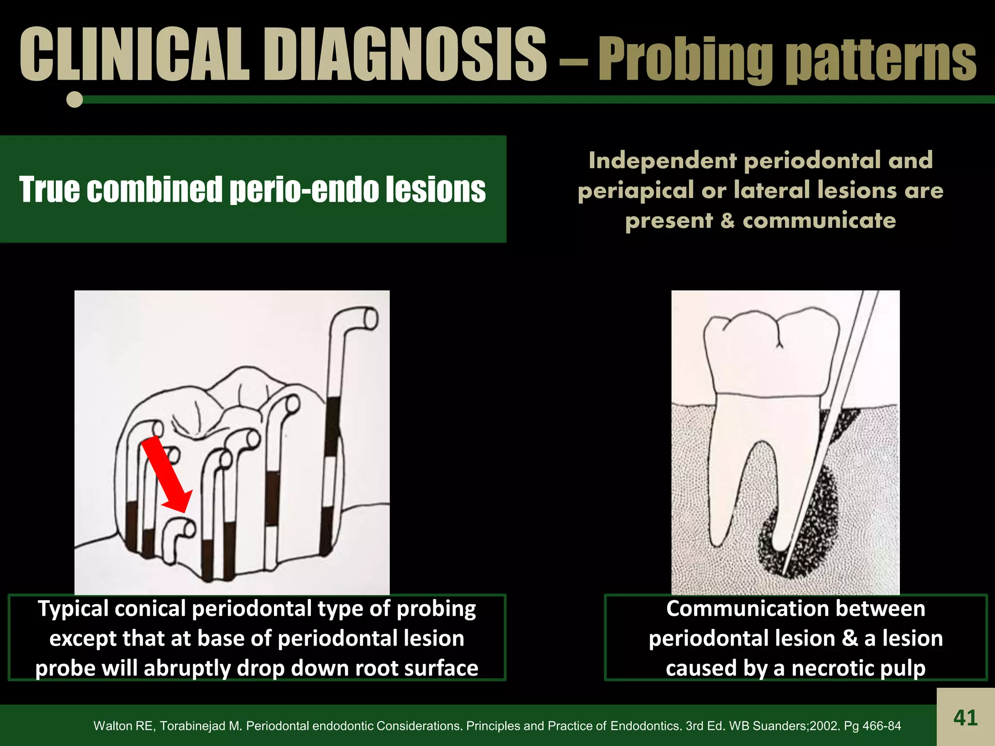 Endodontic Periodontal Relationship, ENDO PERIO LESION | PPTX