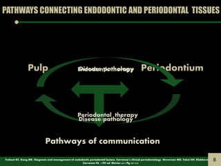 Endodontic Periodontal Relationship, ENDO PERIO LESION | PPTX