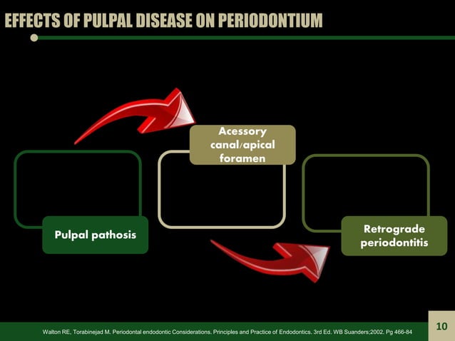 Endodontic Periodontal Relationship, ENDO PERIO LESION | PPTX | Dental ...