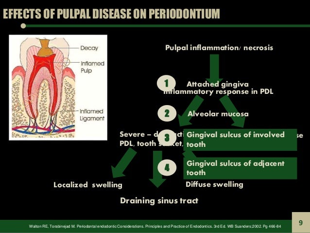 Endodontic Periodontal Relationship, ENDO PERIO LESION