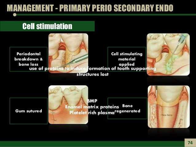 Endodontic Periodontal Relationship, ENDO PERIO LESION