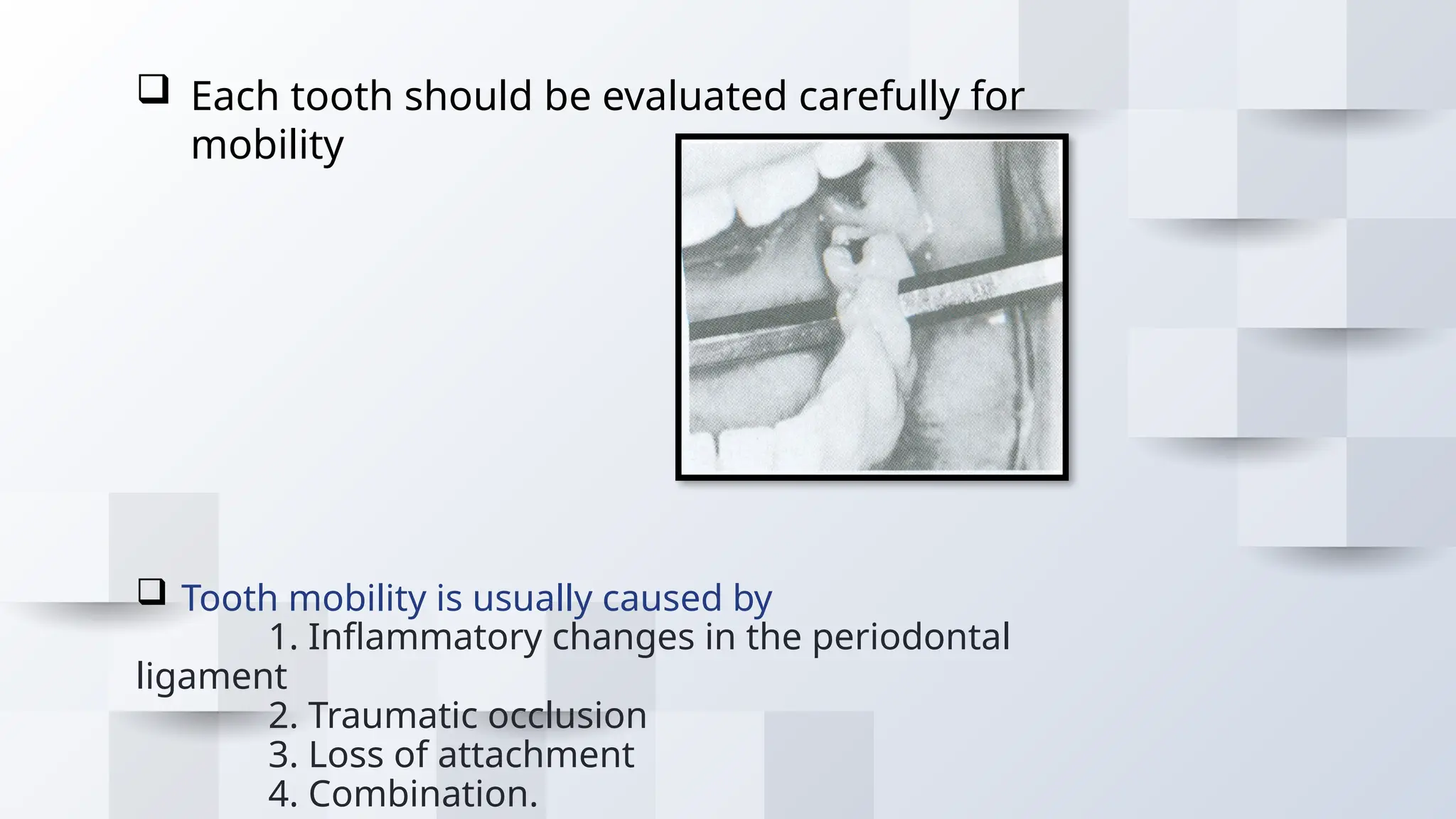 Seminar 5. Mouth preparation for RPD.pptx