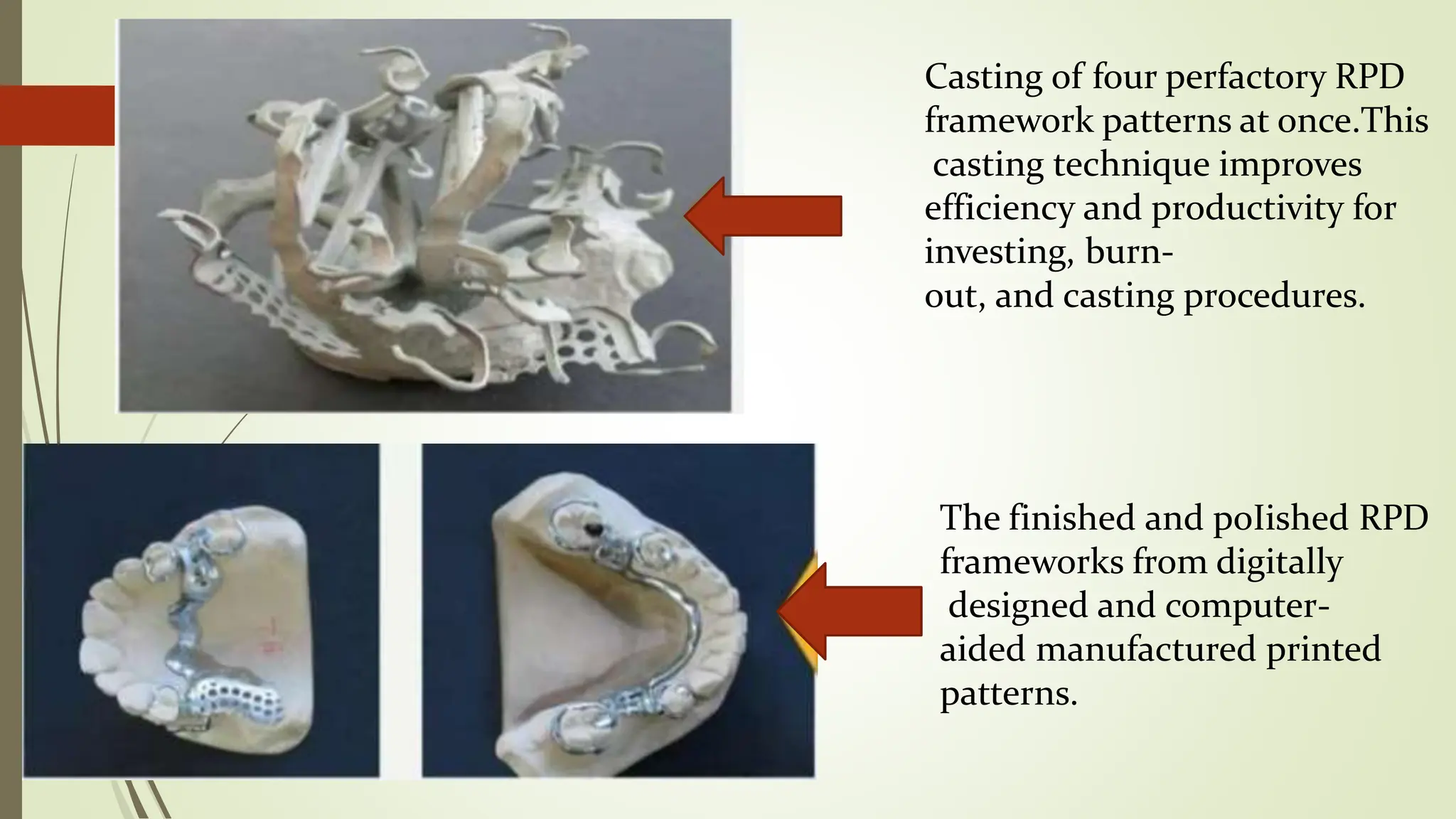 Recent advances in rpd and it's uses in prosthodontics | PPTX