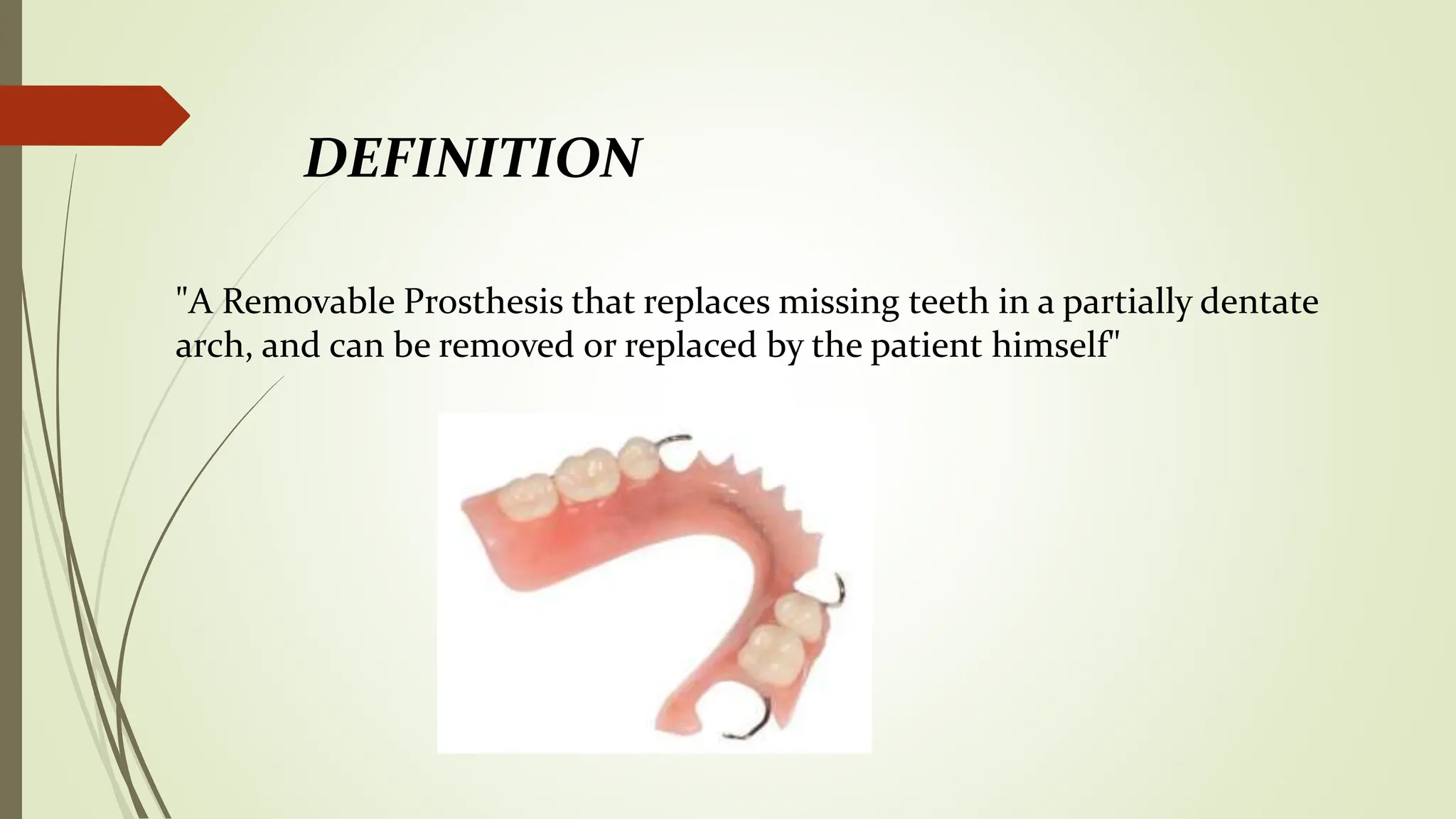 Recent advances in rpd and it's uses in prosthodontics | PPTX