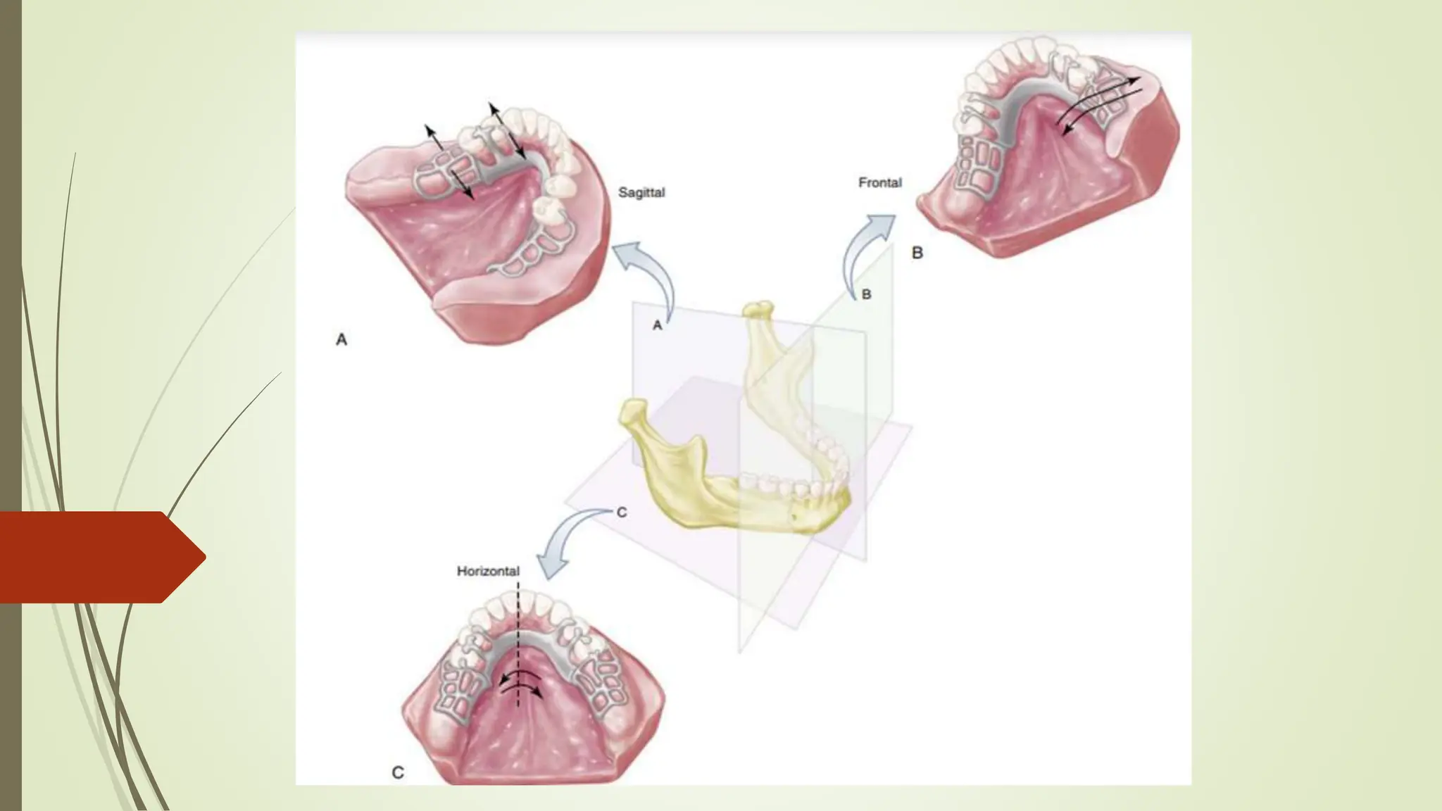 Recent advances in rpd and it's uses in prosthodontics | PPTX