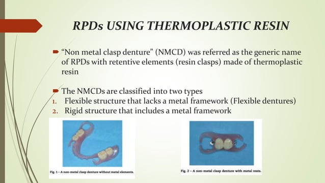 Recent advances in rpd and it's uses in prosthodontics | PPTX