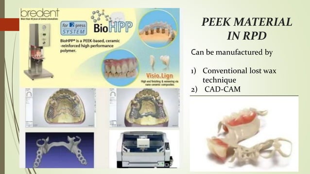 Recent advances in rpd and it's uses in prosthodontics | PPTX