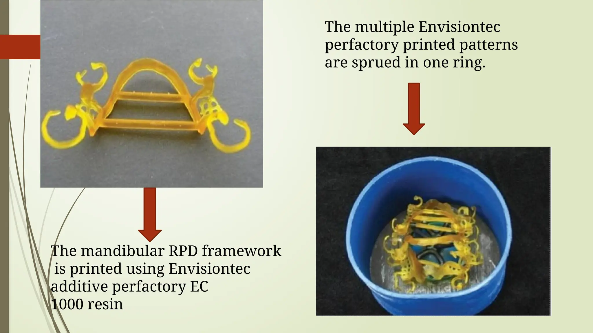 SEMINAR recent advances in Removable partial denture | PPTX