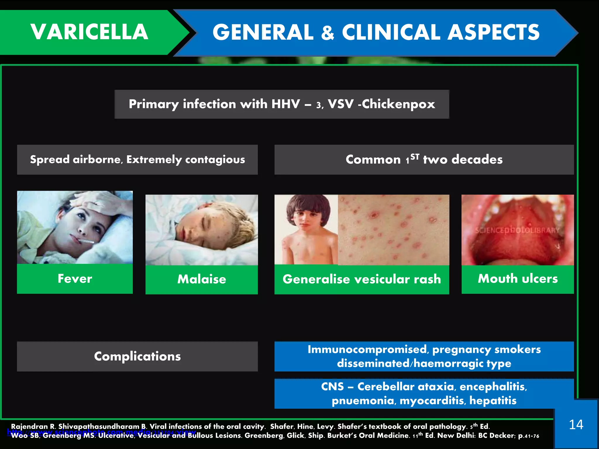 Fungal & Viral Infections Of The Oral Cavity, FUNGAL INFECTIONS, VIRAL ...