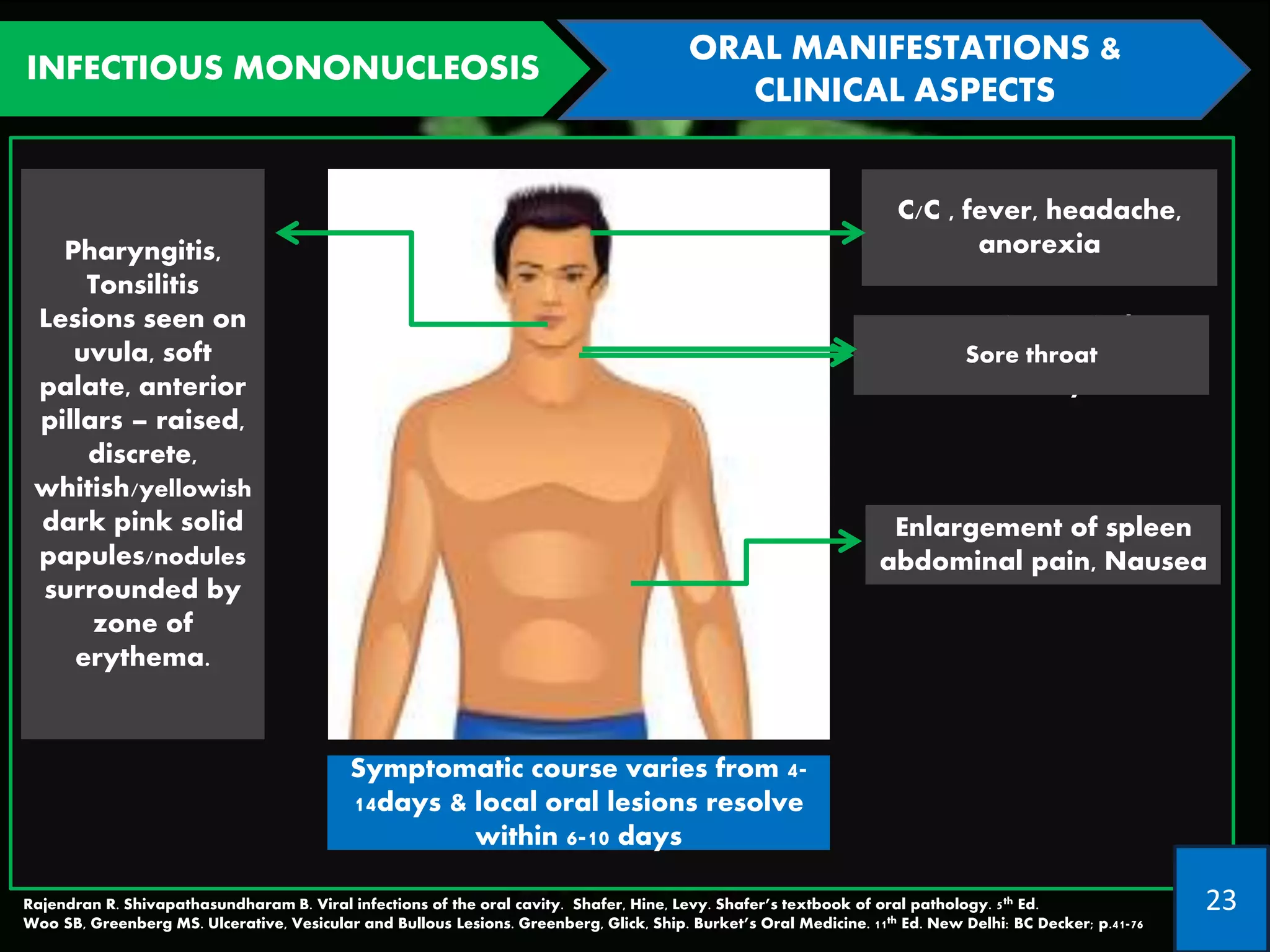 Fungal & Viral Infections Of The Oral Cavity, FUNGAL INFECTIONS, VIRAL ...