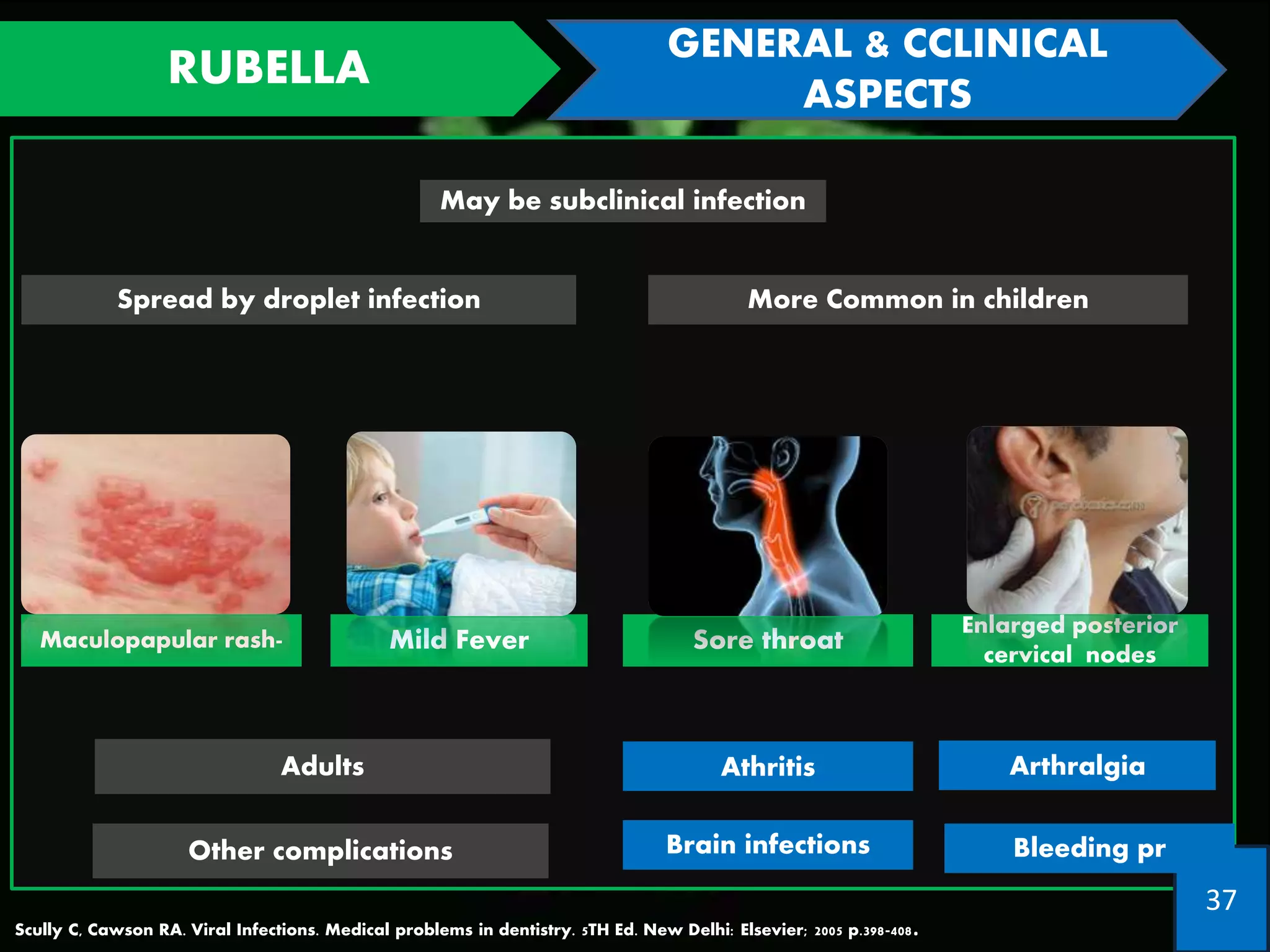 Fungal & Viral Infections Of The Oral Cavity, FUNGAL INFECTIONS, VIRAL ...
