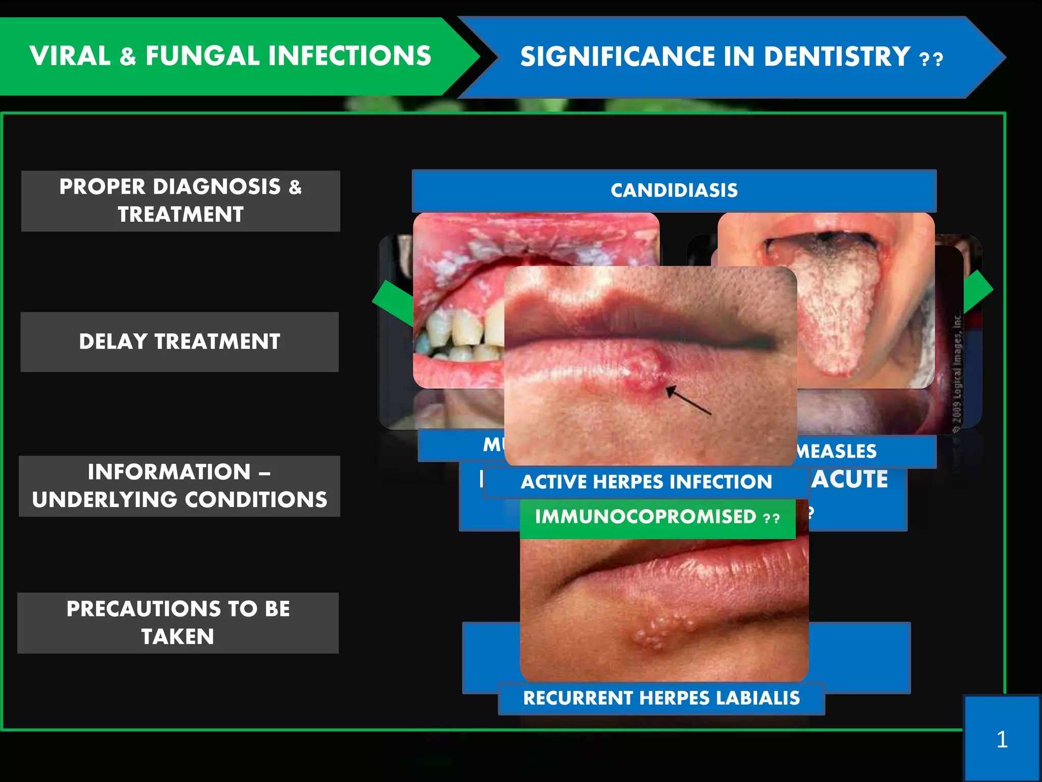Fungal & Viral Infections Of The Oral Cavity, FUNGAL INFECTIONS, VIRAL ...