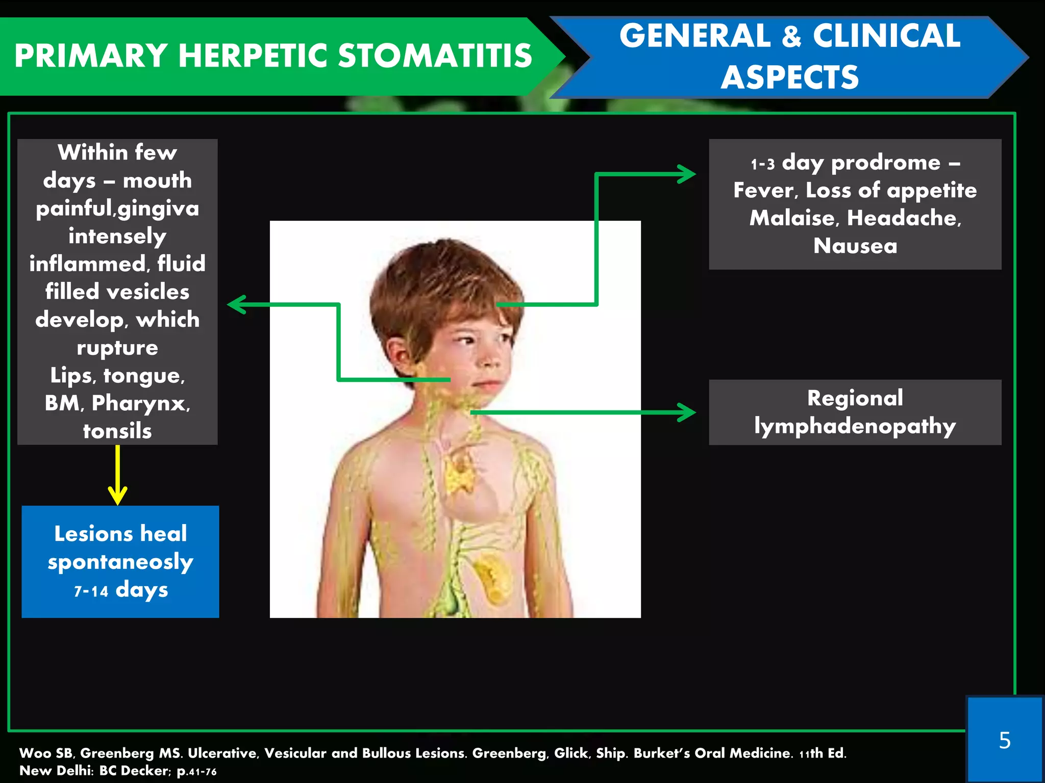 Fungal & Viral Infections Of The Oral Cavity, FUNGAL INFECTIONS, VIRAL ...