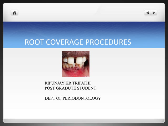 ROOT COVERAGE PROCEDURES | PPTX