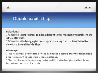 ROOT COVERAGE PROCEDURES | PPTX