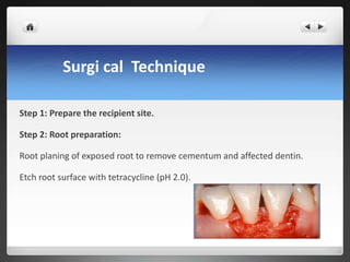ROOT COVERAGE PROCEDURES | PPTX