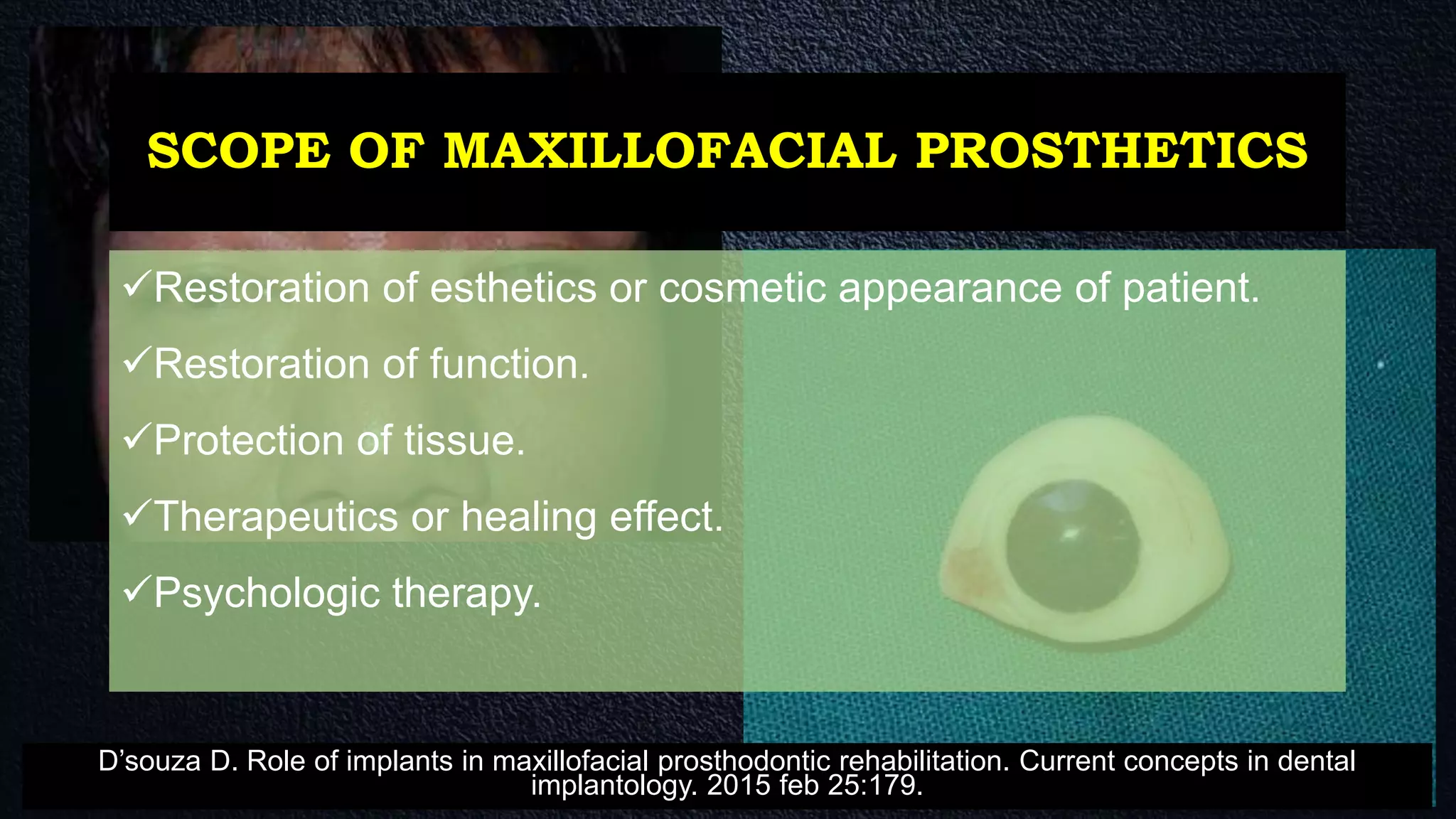 implant retained maxillofacial prosthesis | PPTX