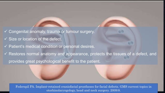 implant retained maxillofacial prosthesis | PPTX | Ear, Nose and Throat ...