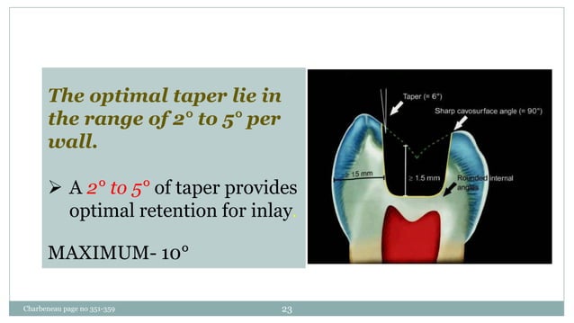 CAVITY DESIGNS FOR INLAY. | PPT
