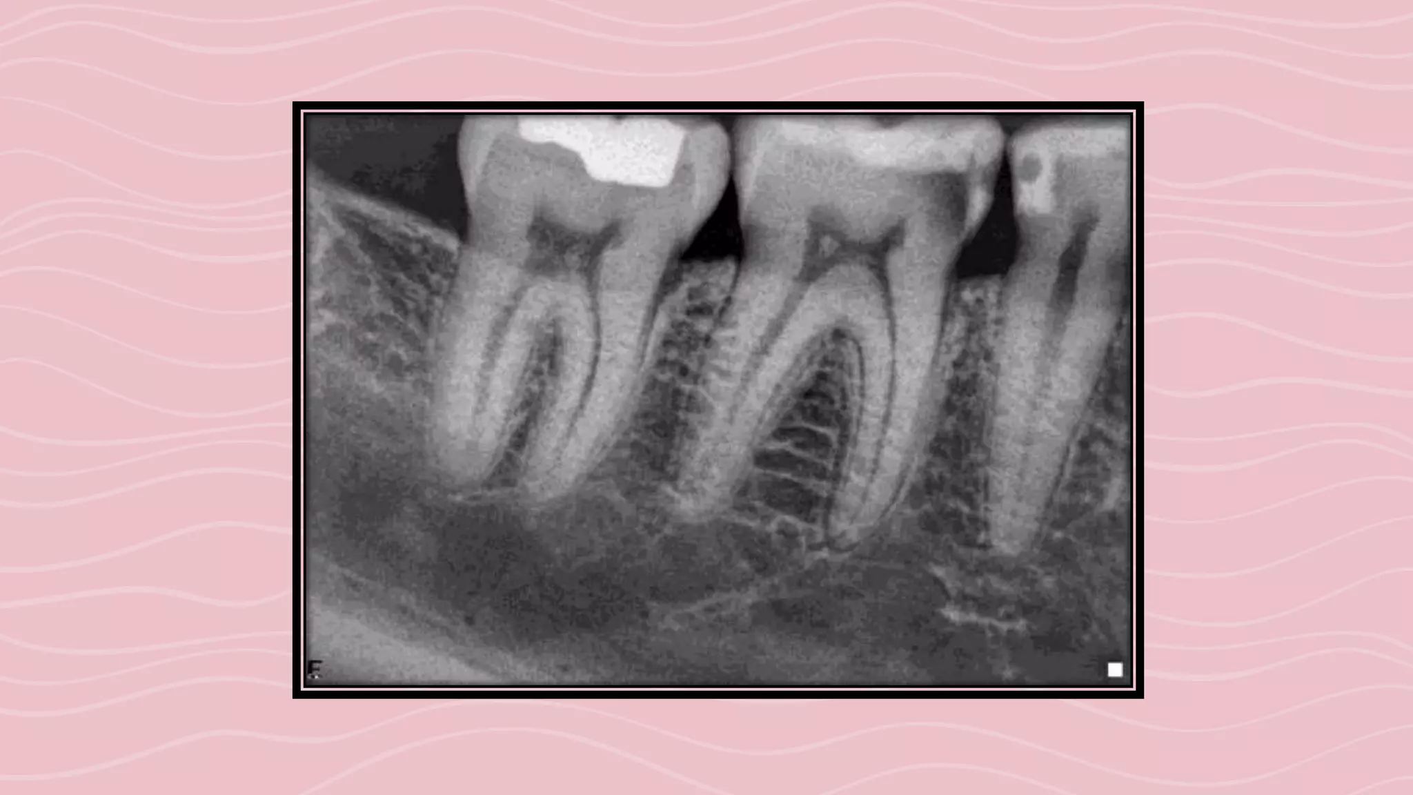 PULP DENTIN COMPLEX | PPTX