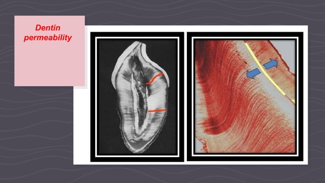PULP DENTIN COMPLEX | PPTX | Dental Health | Diseases and Conditions
