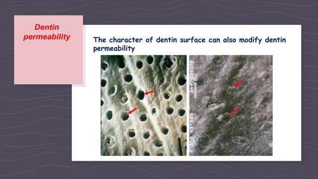 PULP DENTIN COMPLEX | PPTX | Dental Health | Diseases and Conditions