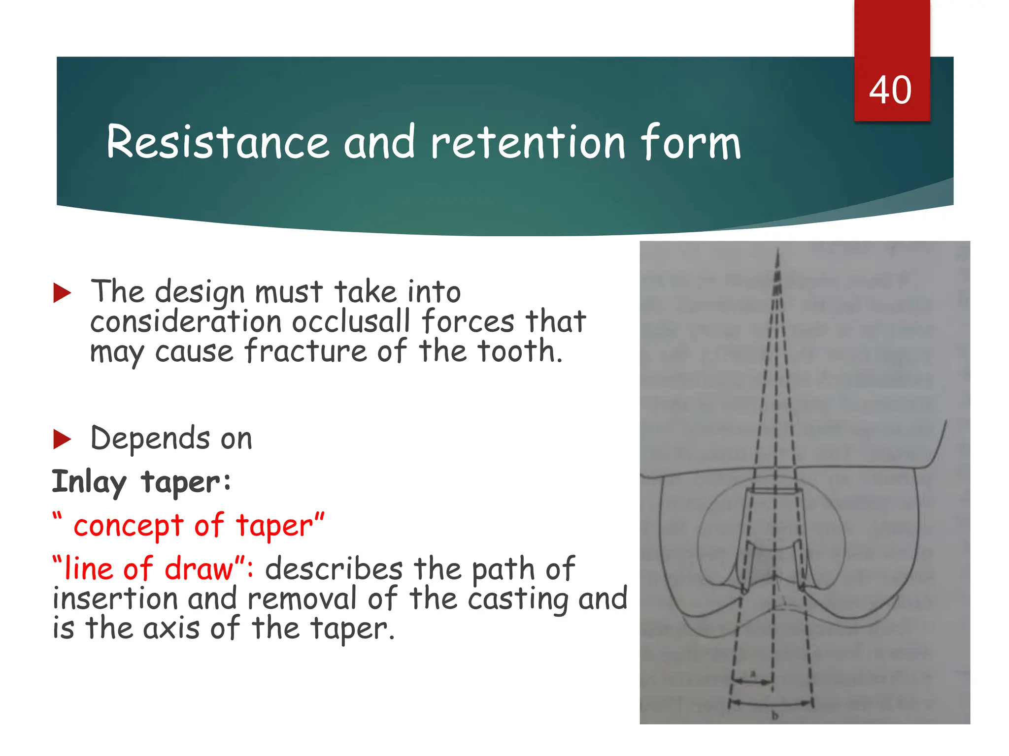 SEMINAR -inlay cavity designs | PPTX