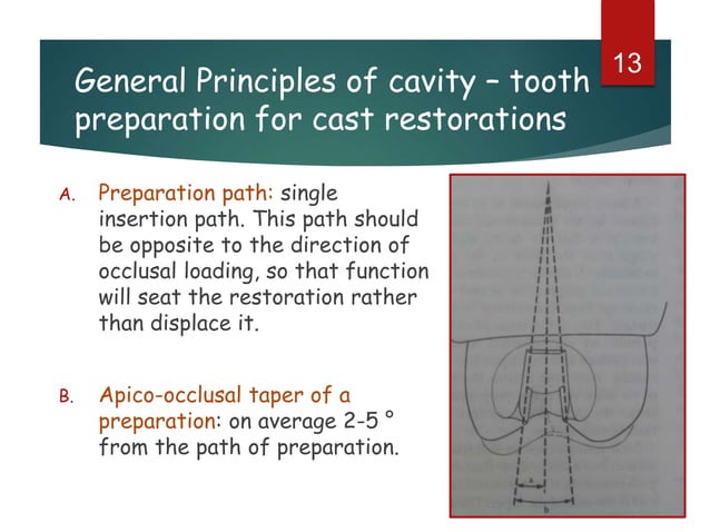 SEMINAR -inlay cavity designs | PPTX