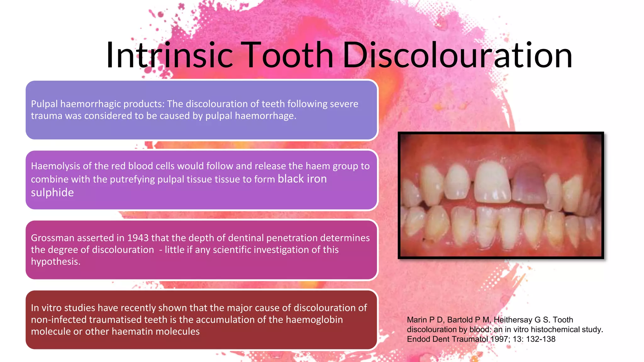 Intrinsic and Extrinsic Discoloration | PPTX