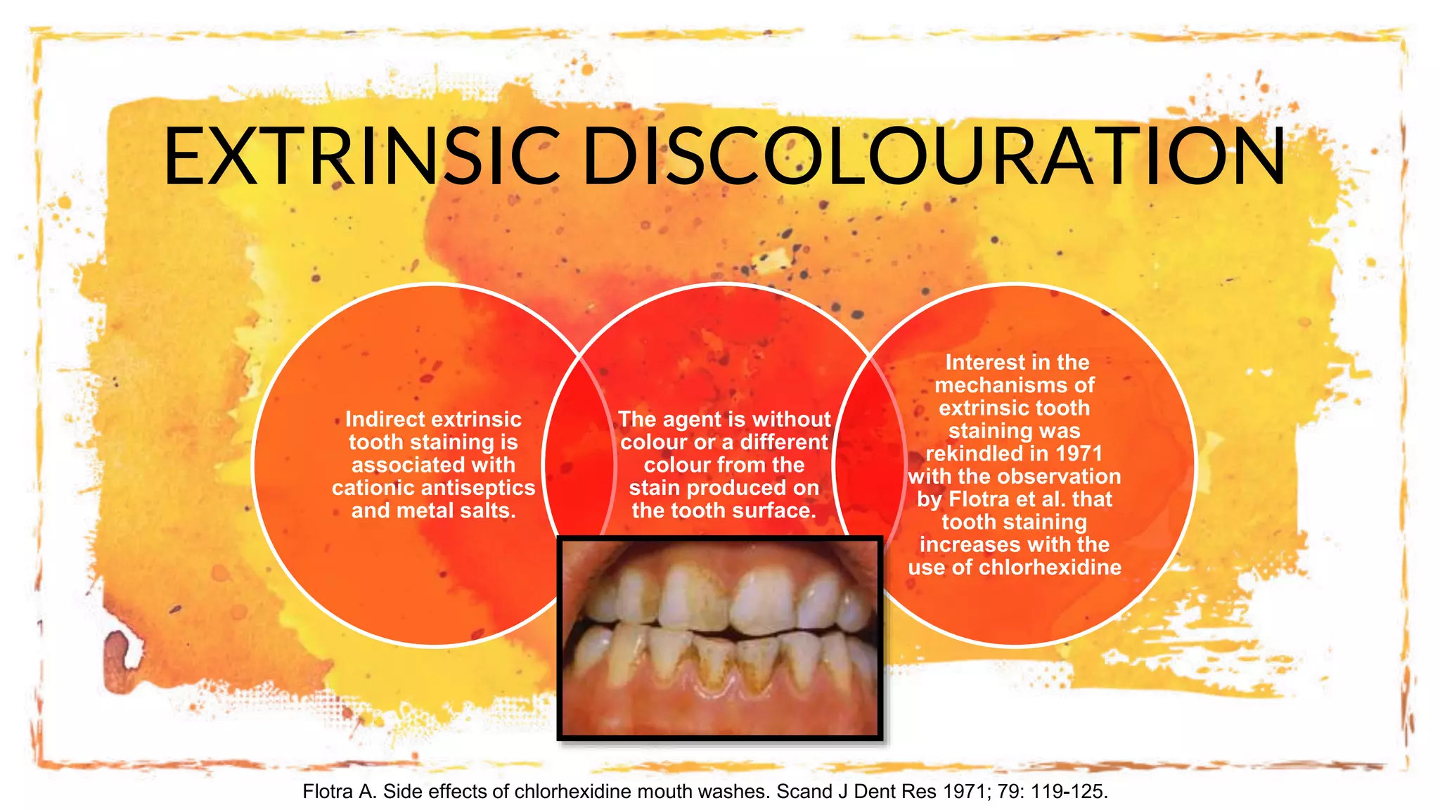 Intrinsic and Extrinsic Discoloration | PPTX