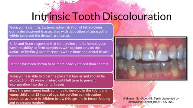Intrinsic and Extrinsic Discoloration | PPTX | Dental Health | Diseases ...