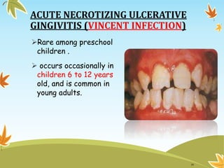 Gingival disease in childhood | PPTX