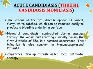 Gingival disease in childhood | PPTX