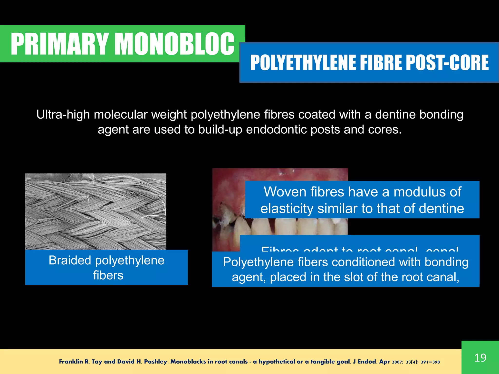 MONOBLOC IN ENDODONTICS - Root canal filling materials and concept of ...