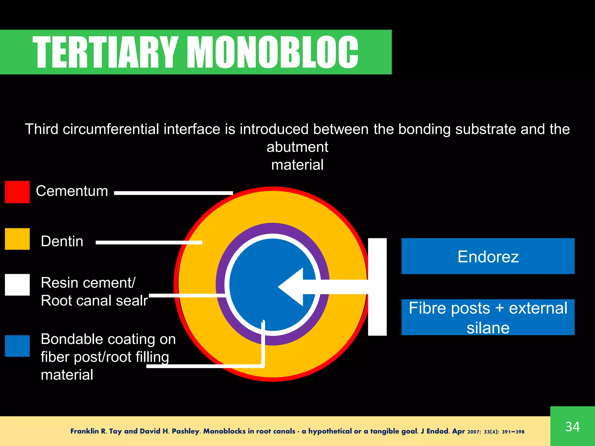MONOBLOC IN ENDODONTICS - Root canal filling materials and concept of ...