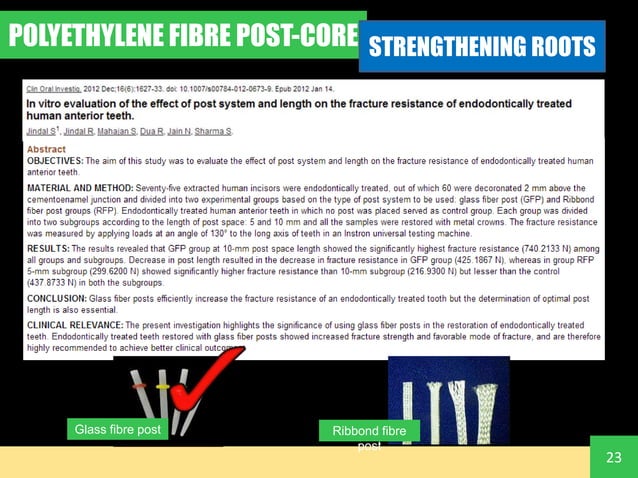 MONOBLOC IN ENDODONTICS - Root canal filling materials and concept of ...