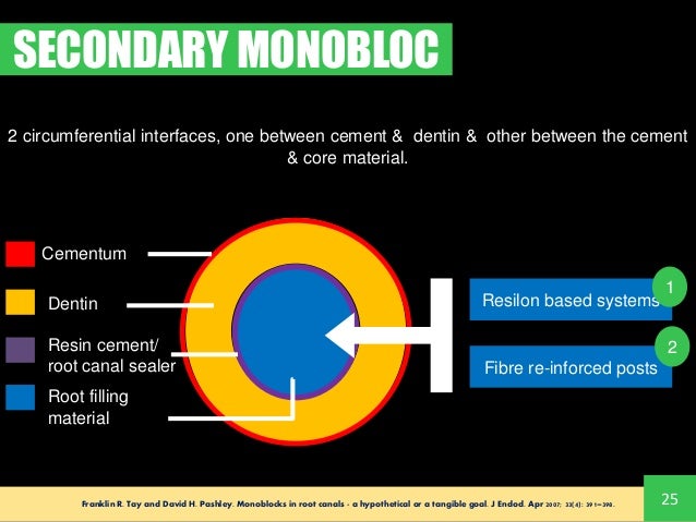 MONOBLOC IN ENDODONTICS - Root canal filling materials and concept of…