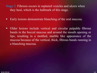 management of oral submucous fibrosis | PPTX