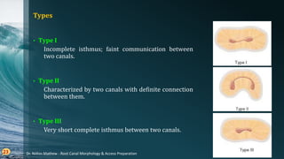 Root Canal Morphology & Access Preparation | PDF
