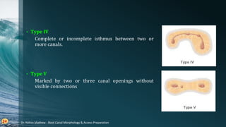 Root Canal Morphology & Access Preparation | PDF