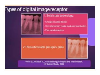 Image receptors in Dentistry | PPTX