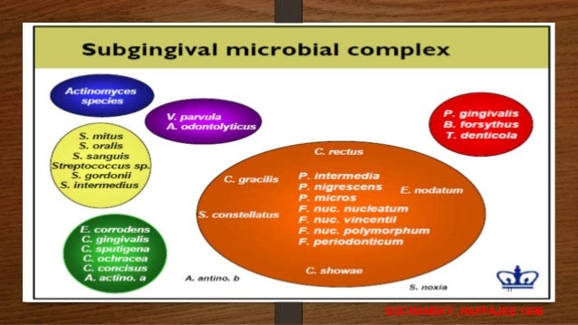 chronic periodontitis