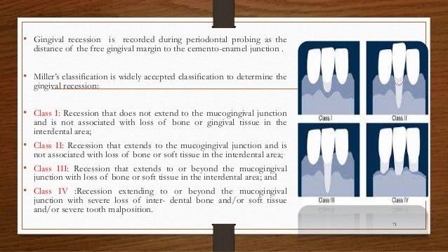 chronic periodontitis