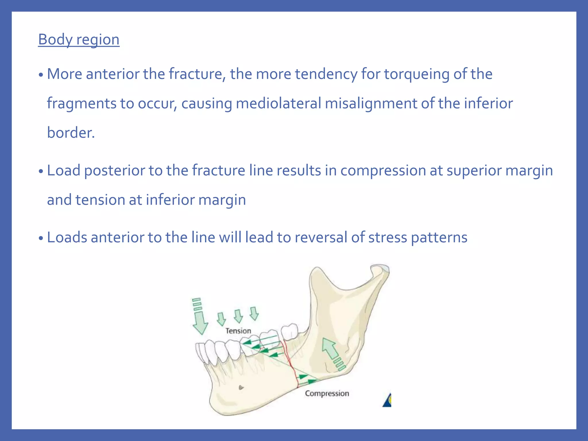 fixation systems in maxillofacial fractures | PPTX