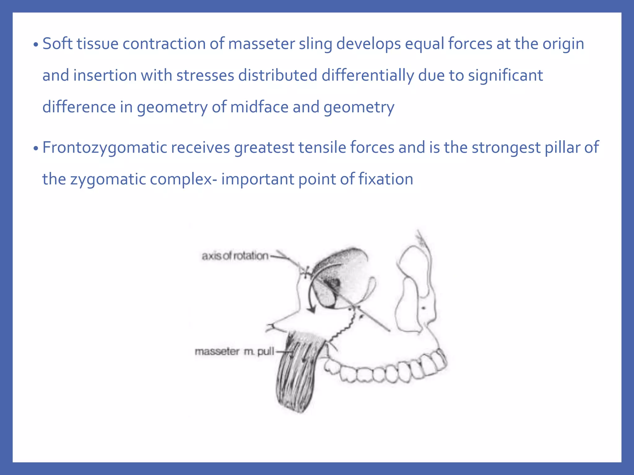 fixation systems in maxillofacial fractures | PPTX