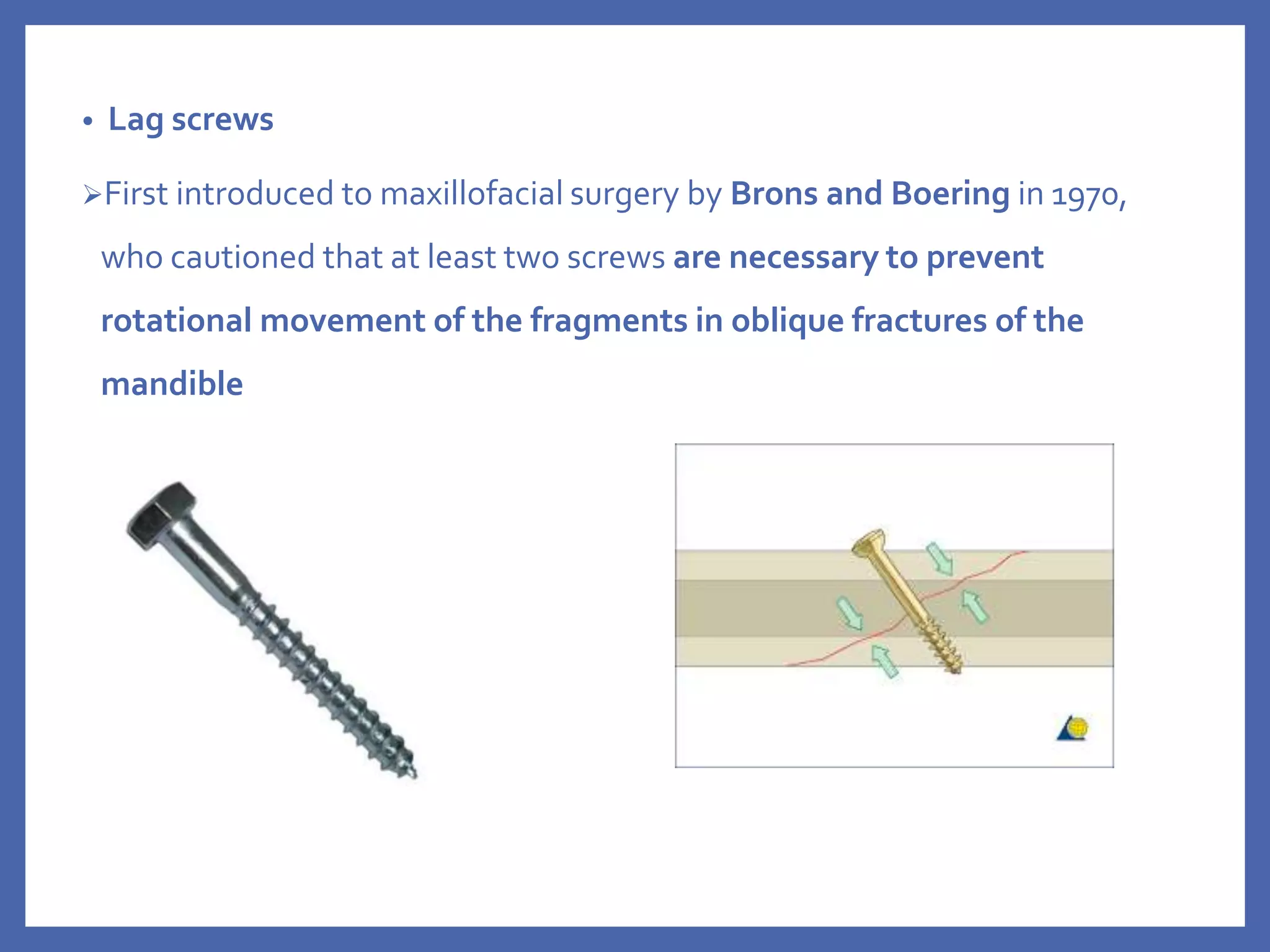fixation systems in maxillofacial fractures | PPTX
