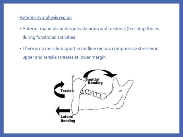 fixation systems in maxillofacial fractures | PPTX