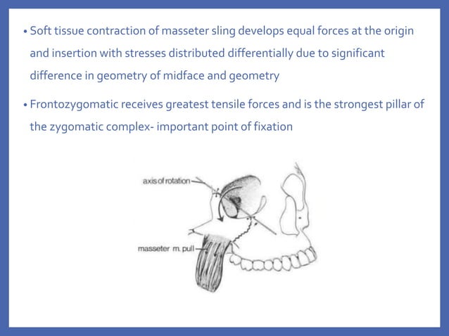 fixation systems in maxillofacial fractures | PPTX